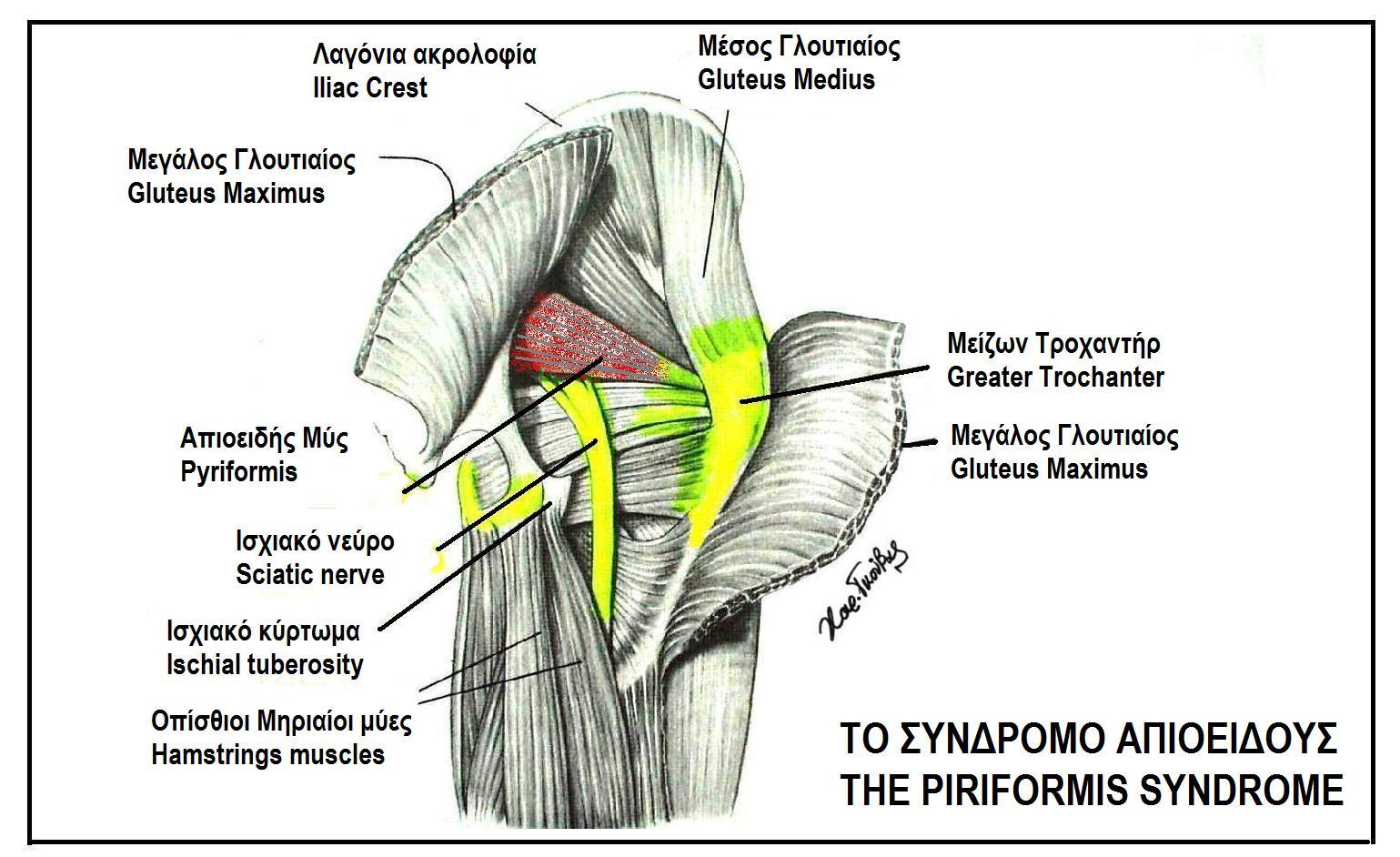 Numb Bums and Back Pain – What is Sciatica? | Osteopaths in Walthamstow ...